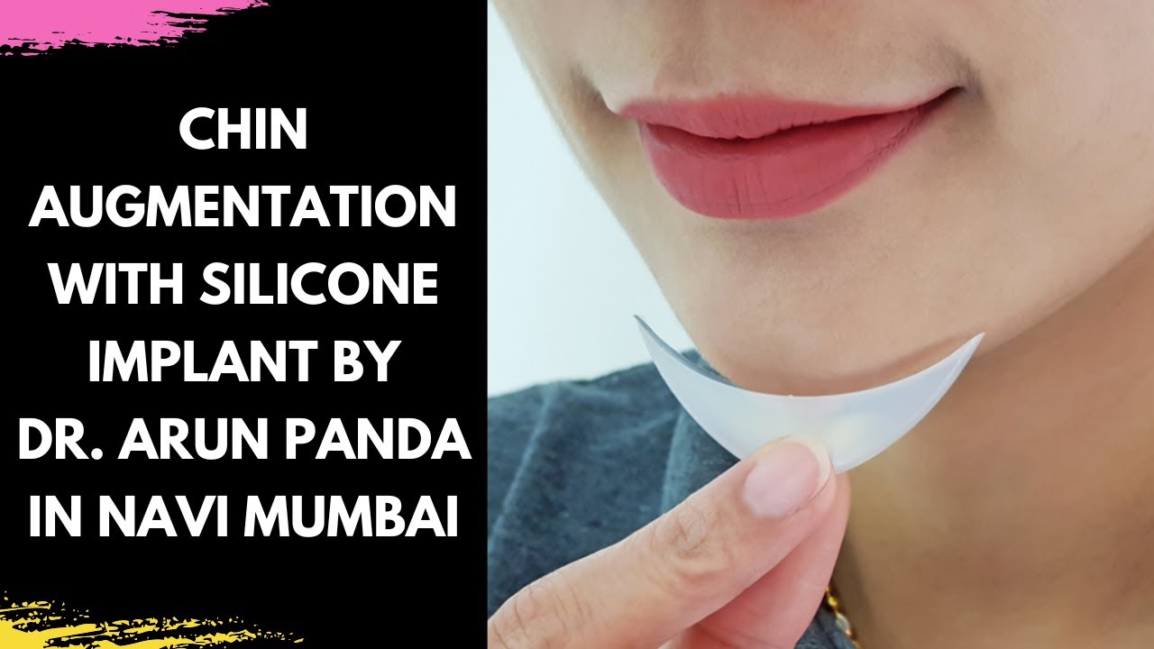 Chin Augmentation with Silicone Implant by Dr. Arun Panda in Navi ...