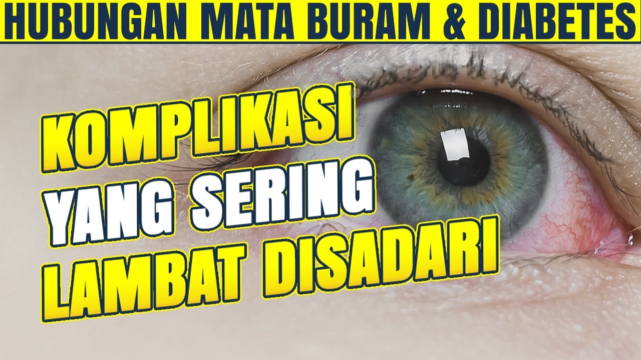 Mata Buram dan Diabetes! Komplikasi yang Sering Terlambat Disadari ...