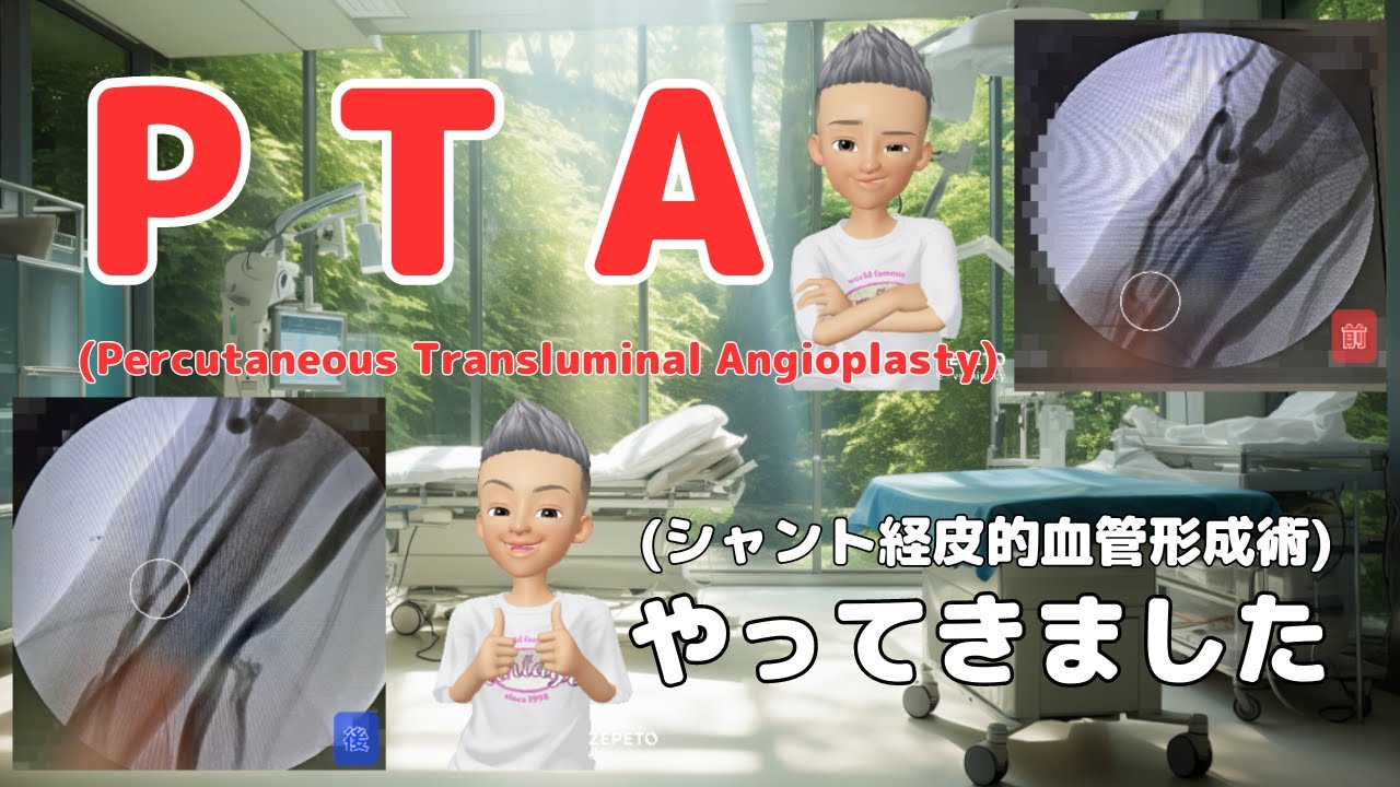 PTA(Percutaneous Transluminal Angioplasty：シャント経皮的血管形成術)やってきました - YouTube
