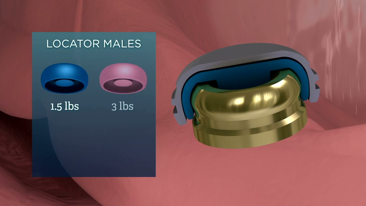 Zest Anchors Locator The Pivoting Difference - YouTube