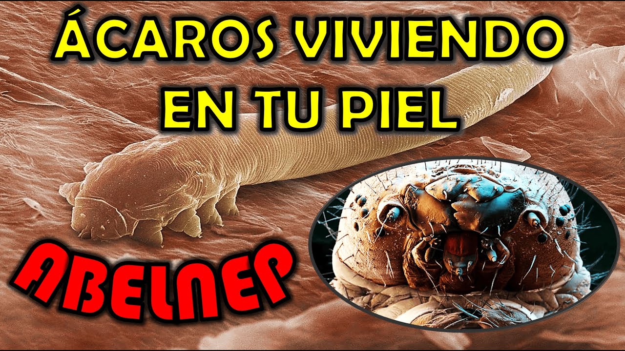 ¡Tienes ácaros en la piel y no lo sabes! Descubre la verdad | Abelnep ...