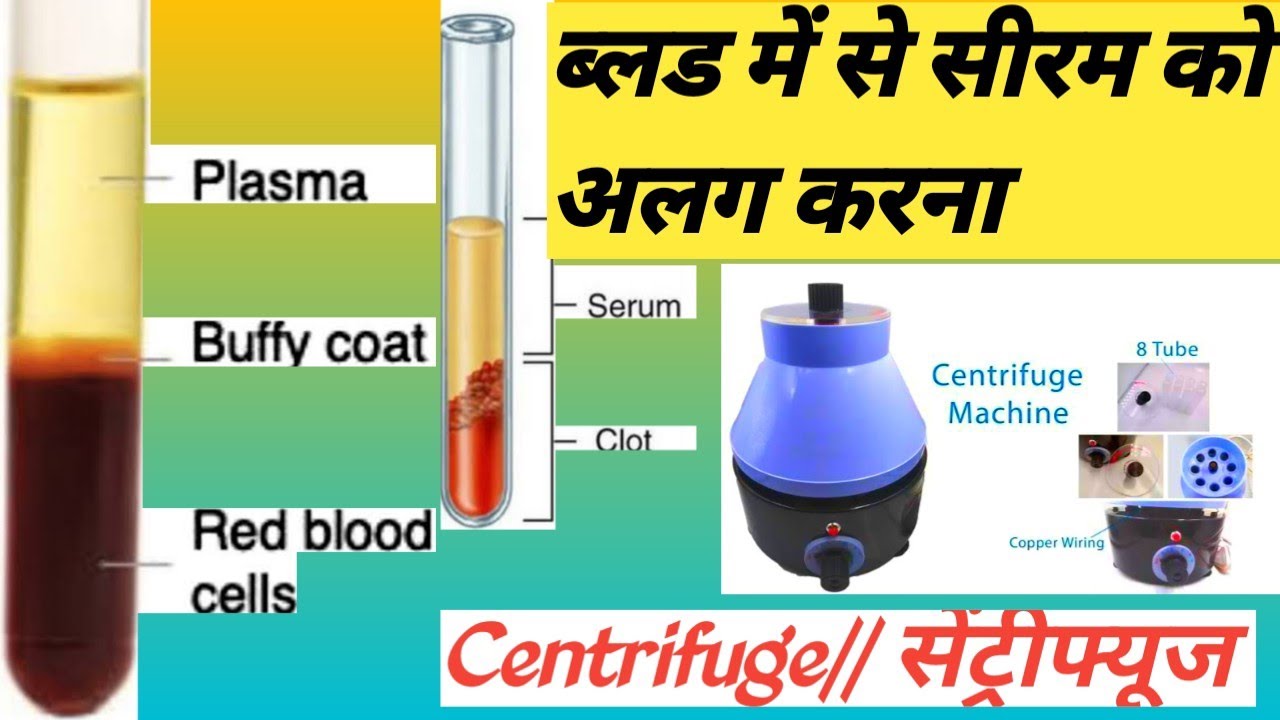 Separating Serum From Blood//सेंट्रीफ्यूज मशीन के द्वारा#BLOOD से#SERUM ...