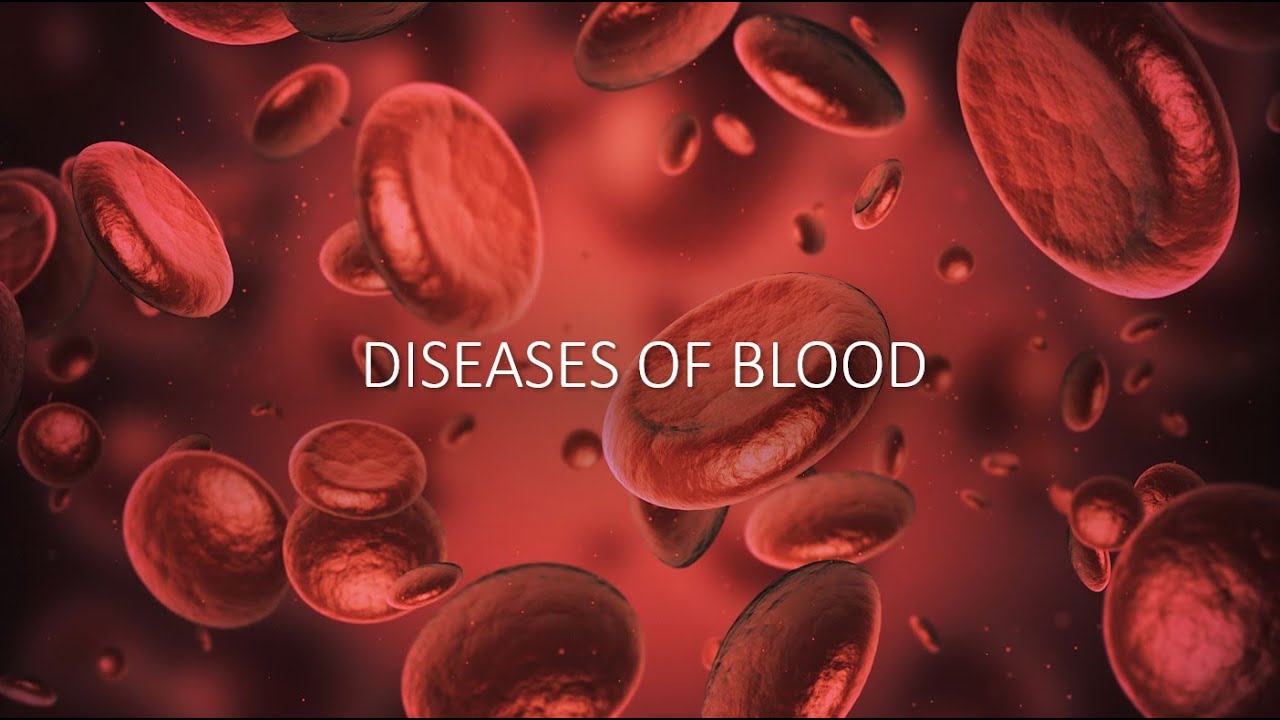 DISEASES OF BLOOD | NEETMDS EXAM NOTES | HEMATOLOGY APPLIED ASPECTS ...