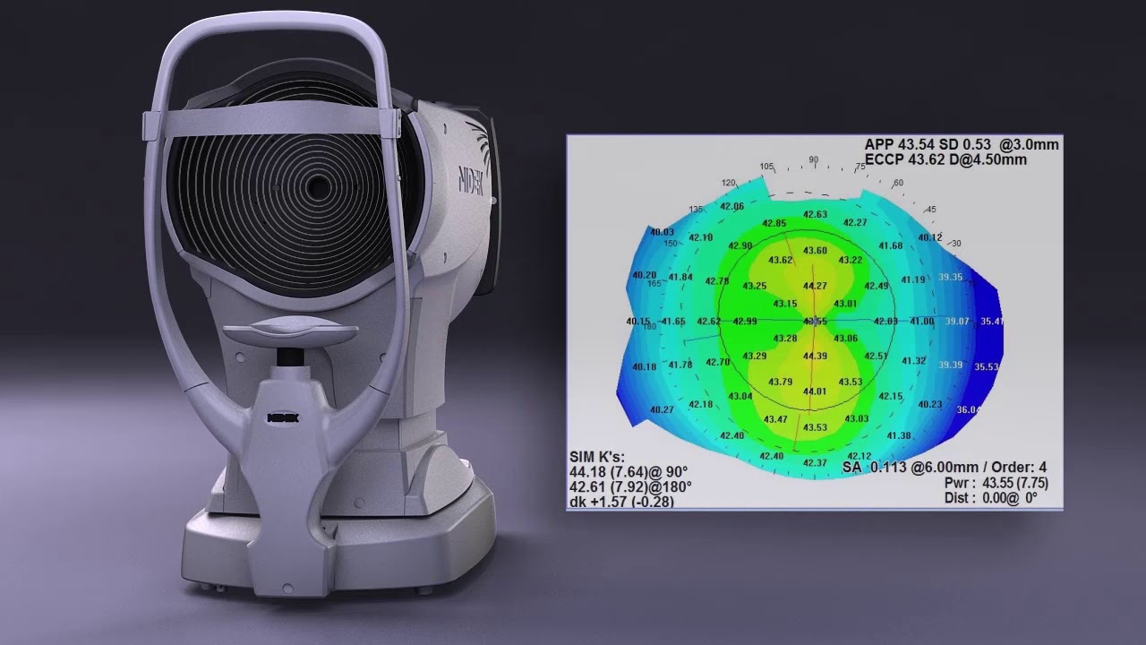 OPD Scan III ITA - YouTube