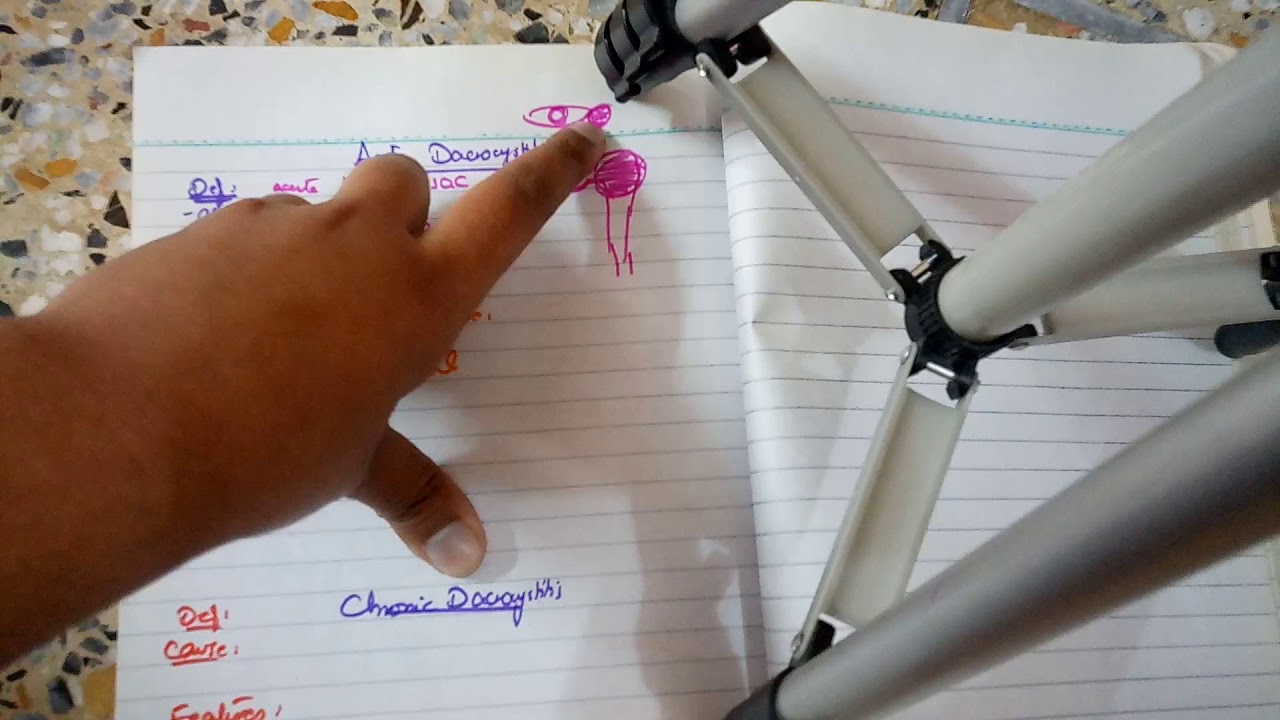 ACUTE DACROCYSTITIS lacrimal system lecture 3 made so simple with ...