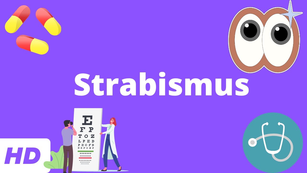 Strabismus: Everything You Need To Know - YouTube