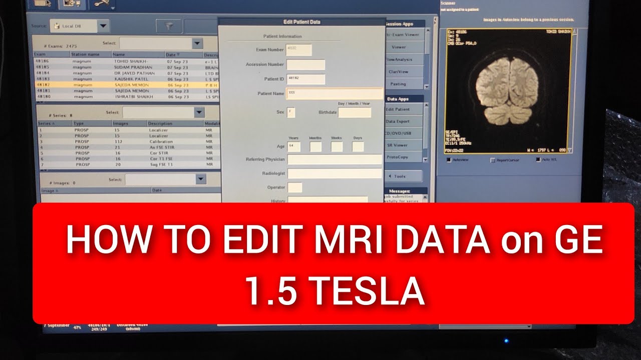 How to Edit MRI Data on GE 1.5 Tesla on YouTube - YouTube