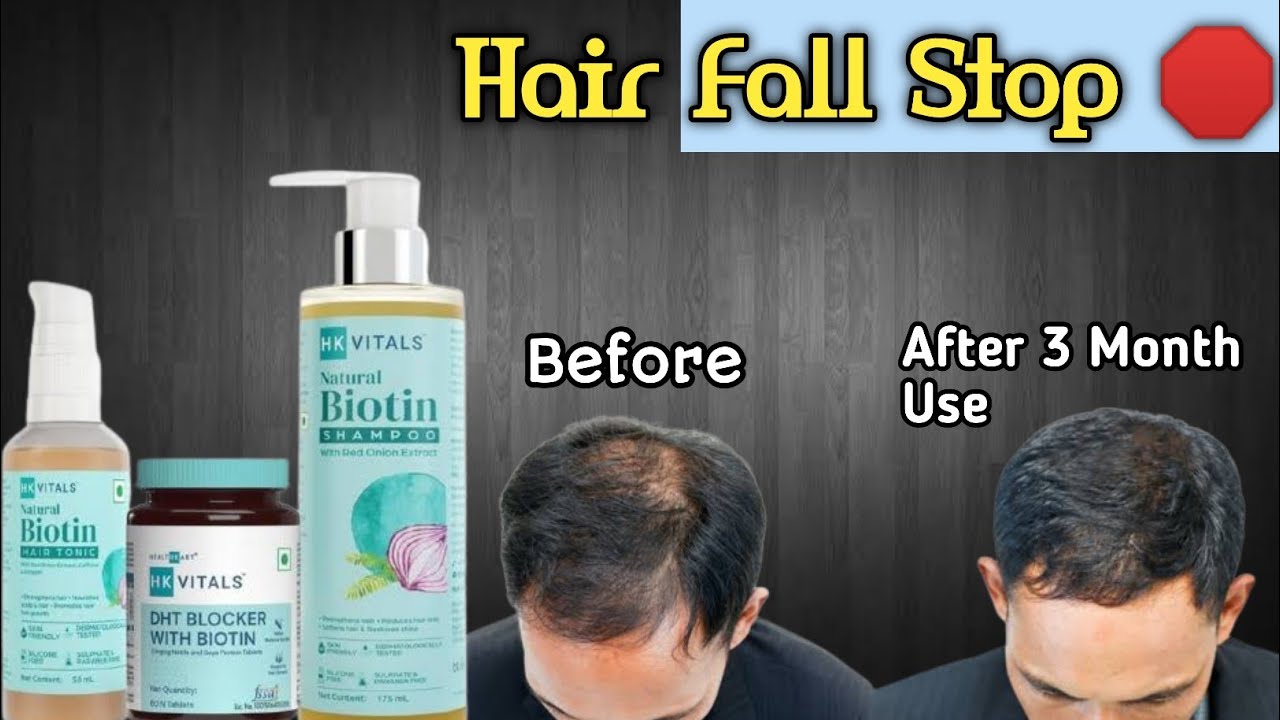 Hair Fall Kit For Men | Hair loss Kit | Hair Regrowth Product | Hair ...