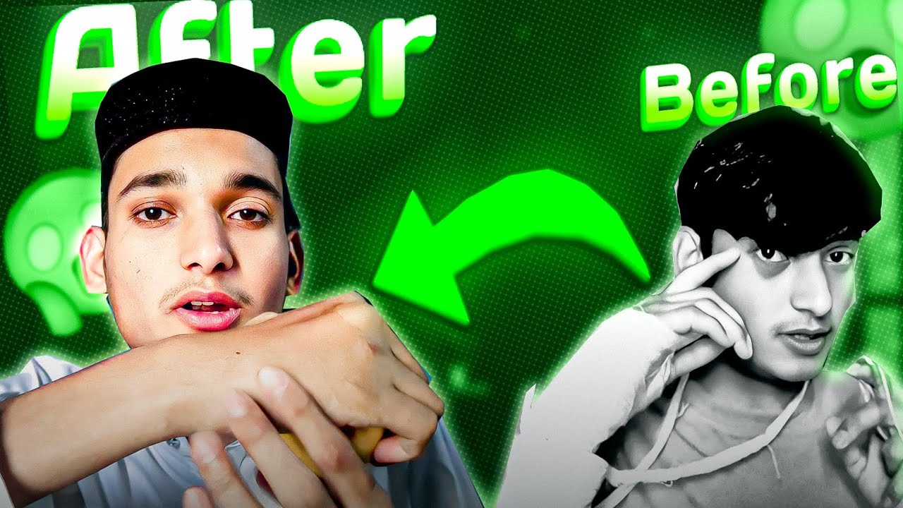 Accident TODAY Story Vlog😵| Before and After By Sameer Vlogger - YouTube