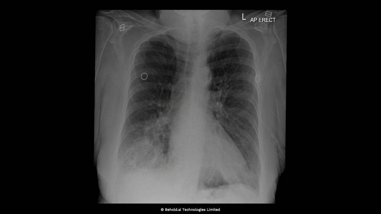 behold.ai red dot® Artificial Intelligence in action - YouTube