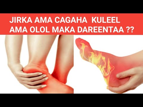 #CAGA HURKA SIDA UGU FUDUD EE LOO DAAWEEYN KARO CAGA HURKA AMA CAGA OLOLKA ???