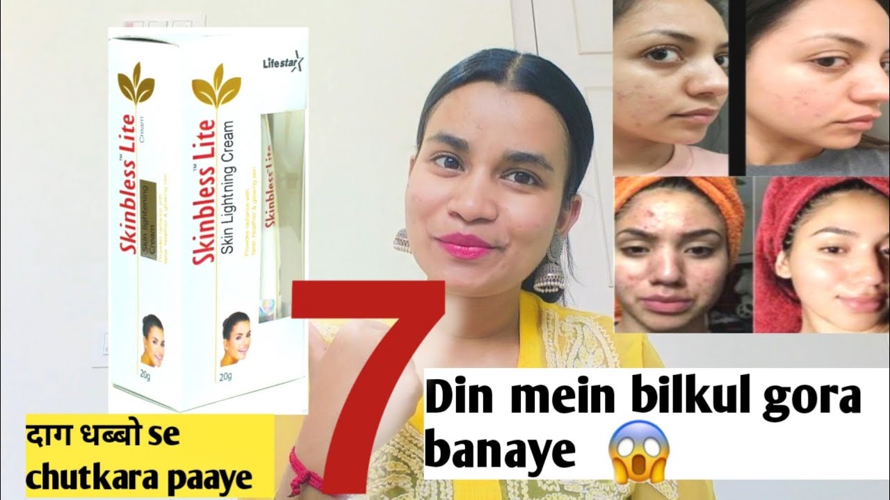 use करने का सही तरीक़ा | skinbless cream | skinbless cream review| skin ...