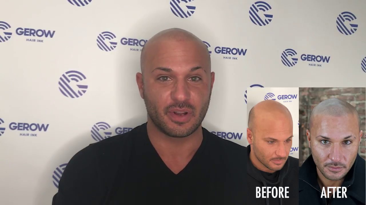 CHRISTOPHER'S TOUCHING TESTIMONIAL - GEROW HAIR INK - SCALP ...