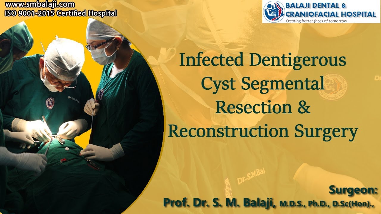 Infected dentigerous cyst-Segmental Resection & Reconstruction Surgery ...