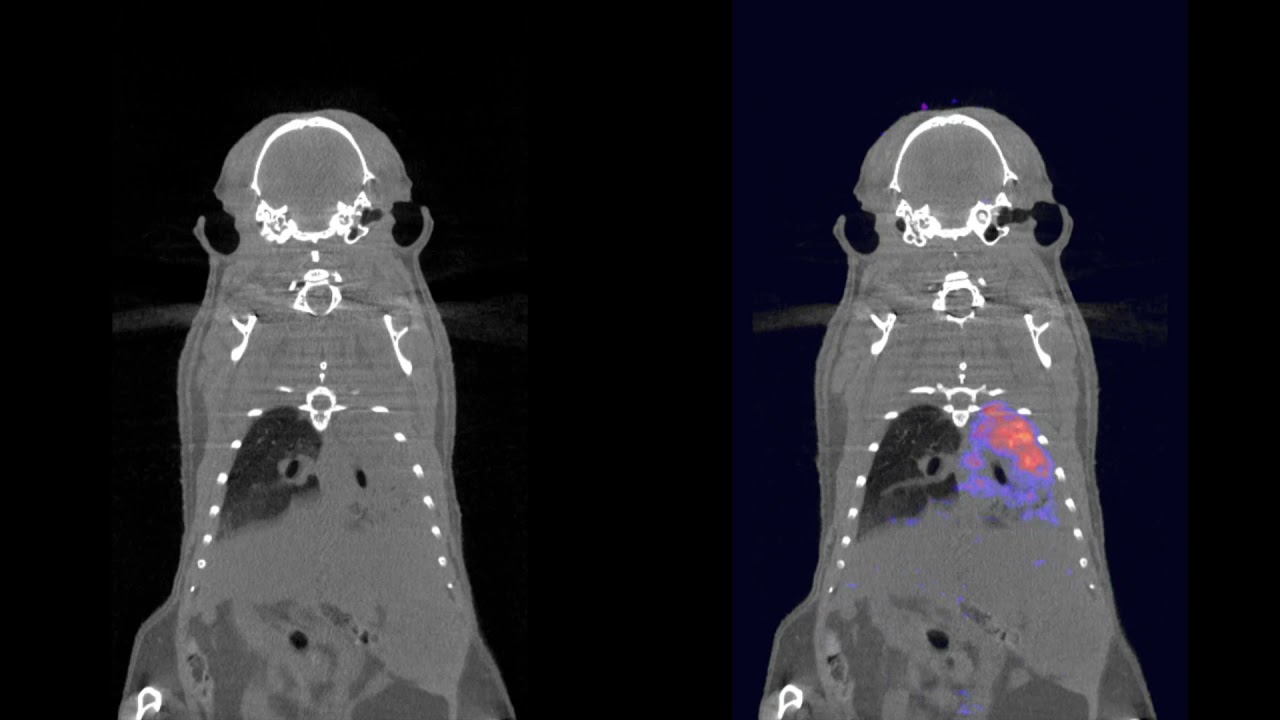 Monitoring Bacterial Infections with Imaging Agent - YouTube