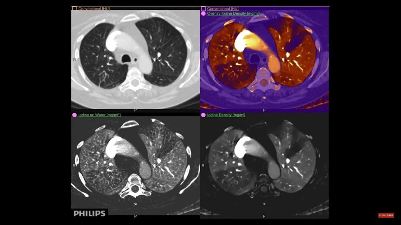 See the world’s first and only detector-based spectral technology with ...