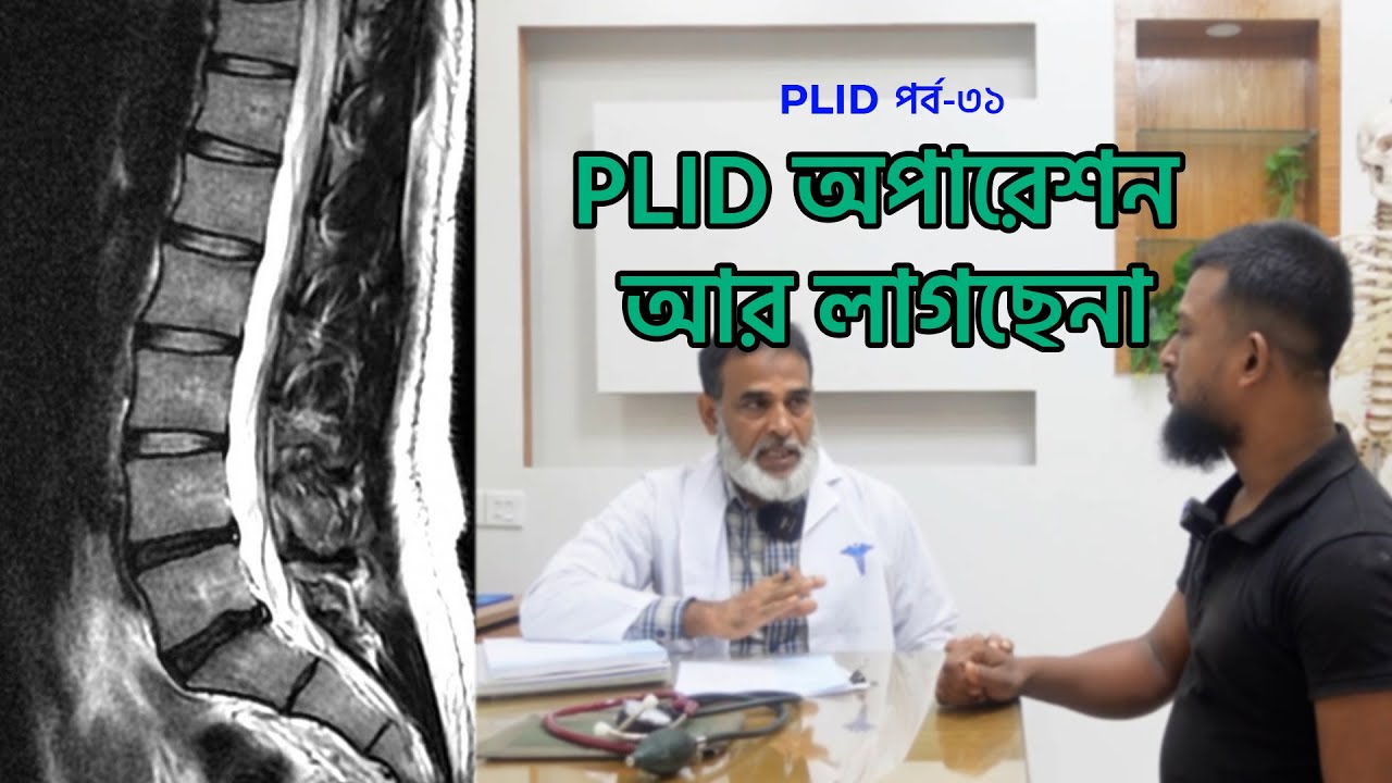 PLID 31 | PLID অপারেশন আর লাগছেনা | Needed No PLID Surgery | Doctor ...