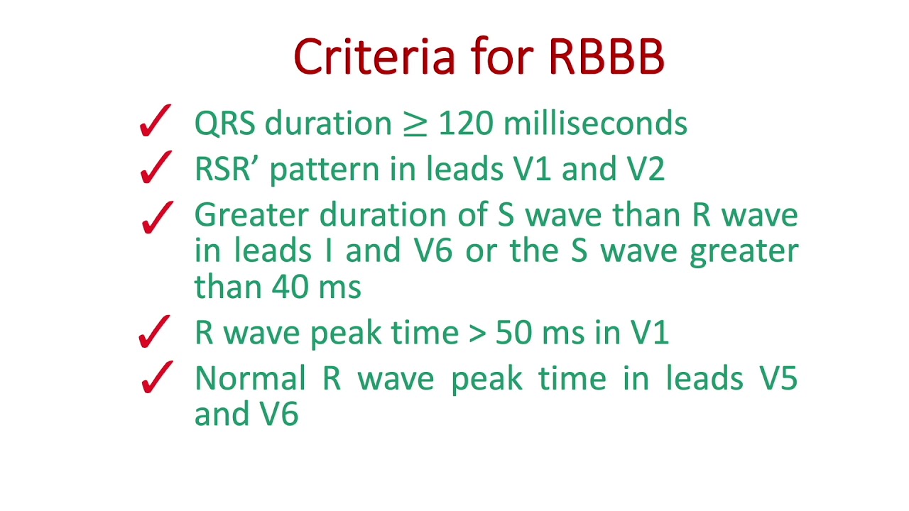 How to identify right bundle branch block (RBBB) in an ECG? - YouTube