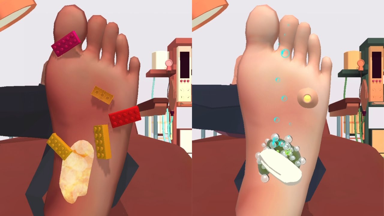 ASMR Foot Care game! Relaxing sounds! Satisfying ASMR Video (Part 8 ...