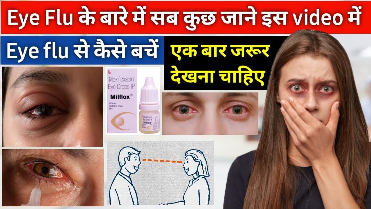 Eye flu hone par kya karen | eye infection treatment | moxifloxacin and ...