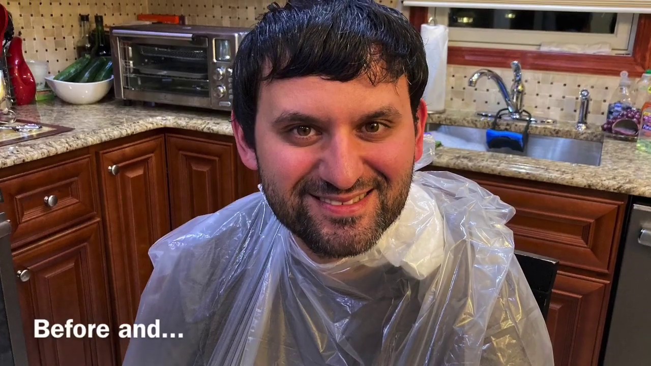 AT HOME HAIRCUT AND STARTING EPOGEN INJECTIONS (6/12-6/15/2020) - YouTube
