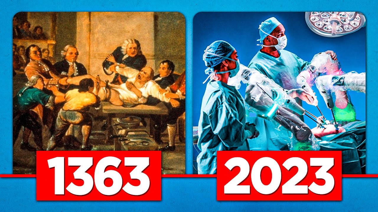 Surgery Evolution ( 6500 BCE - 2023 ) - YouTube
