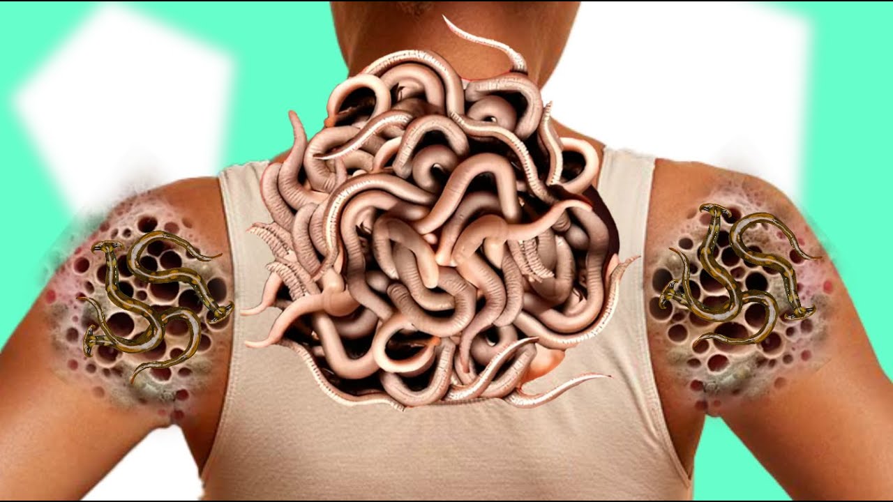 Face care Deep cleaning asmr animation treatment spider & maggots ...