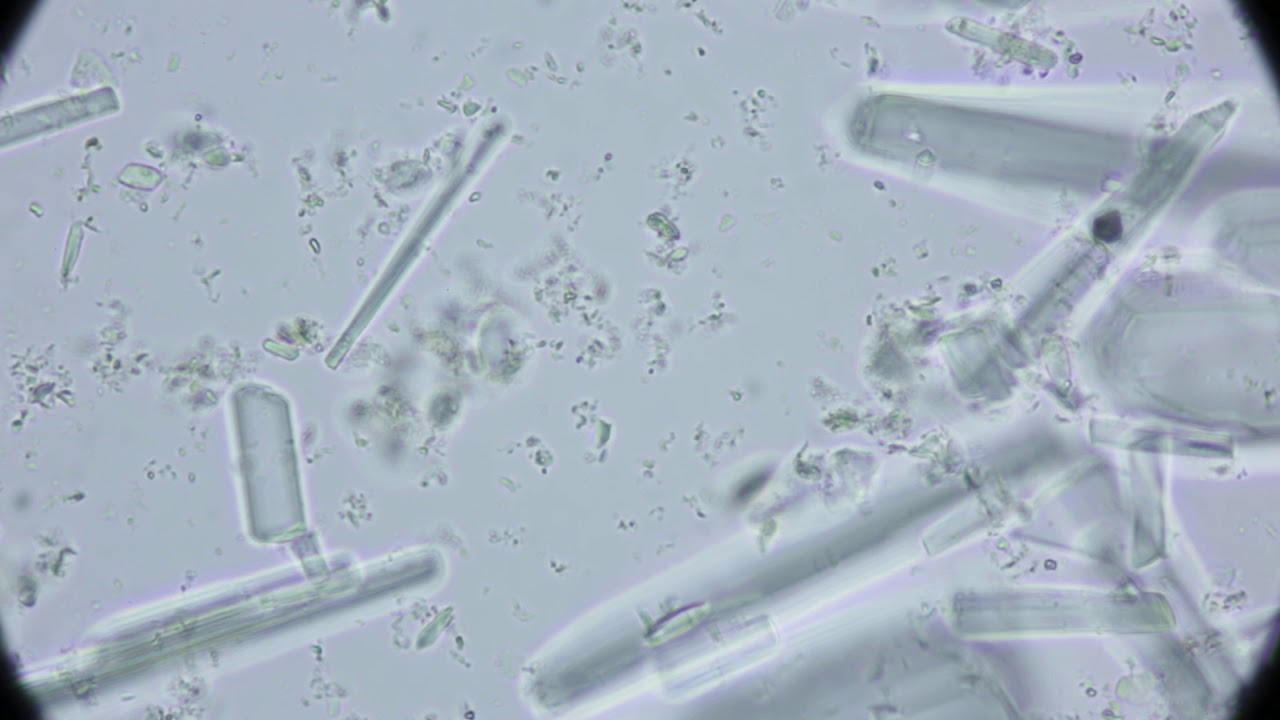 Antarctic Bacteria (science pending) (200x) from Don Juan Pond Sediment ...