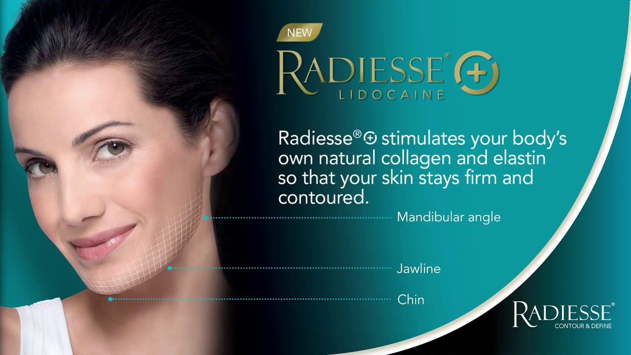 Merz Radiesse® @ Iconic Medical Skin & Laser Center - YouTube