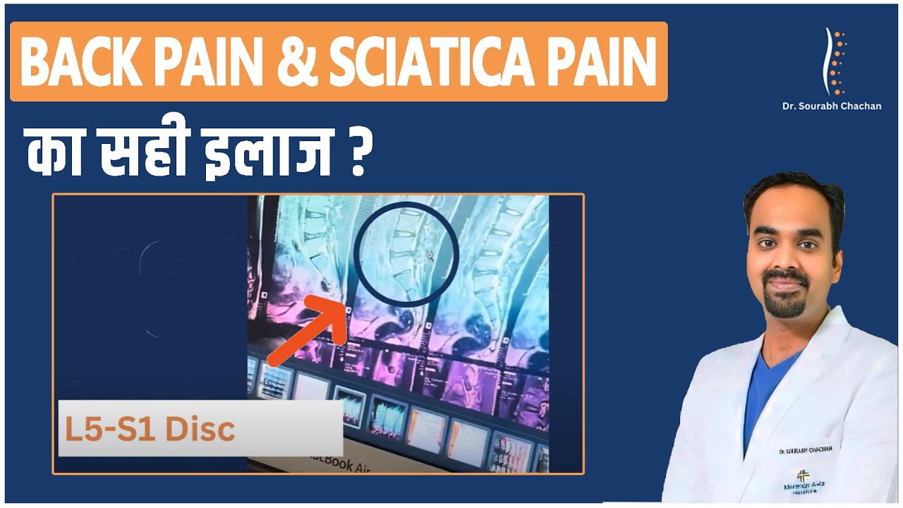Back Pain & Sciatica Relief Amit’s MRI Case Explained by Dr. Sourabh Chachan |Spine Endoscopy ...