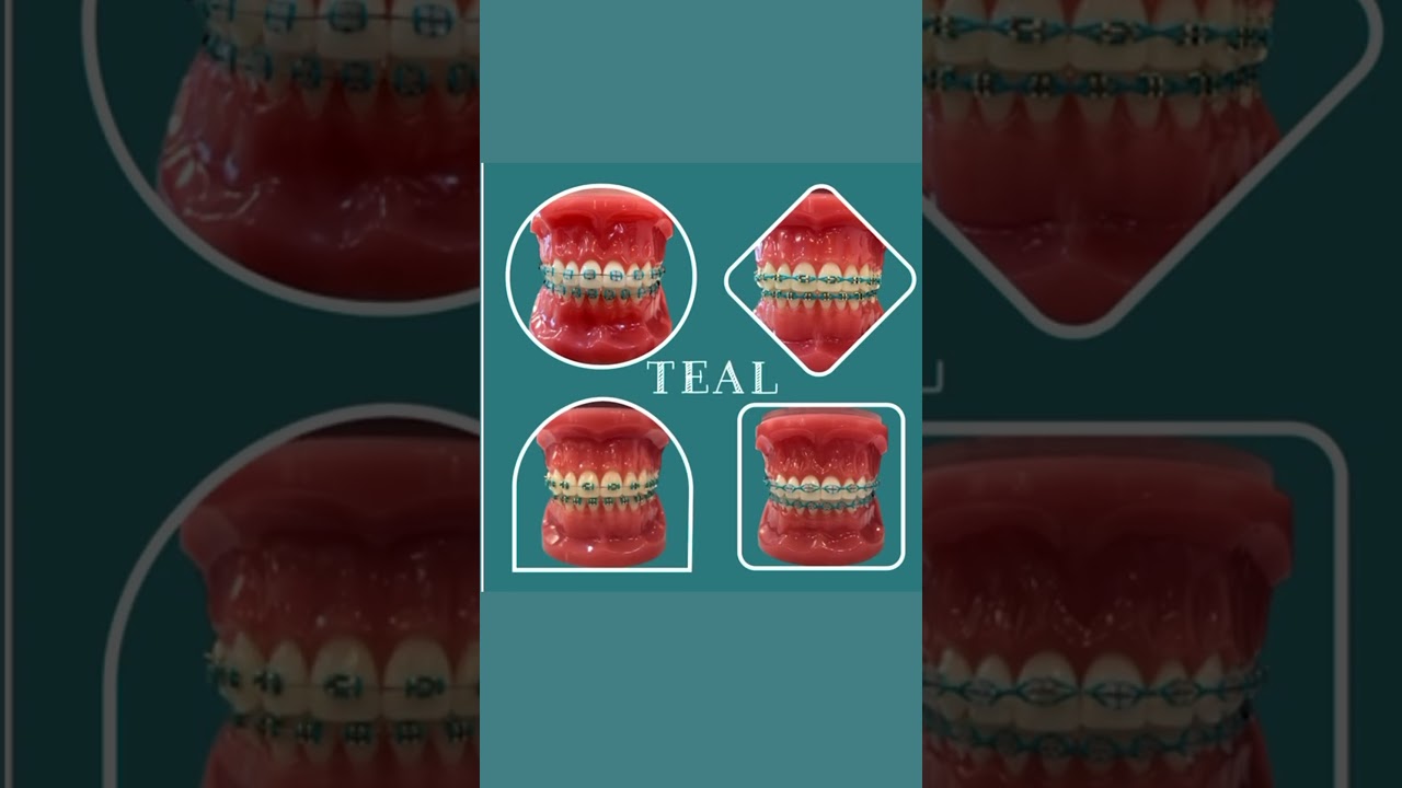 Teal Braces For Teeth