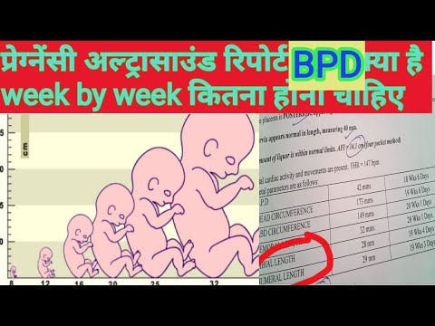 what is BPD in pregnancy ultrasound report - YouTube