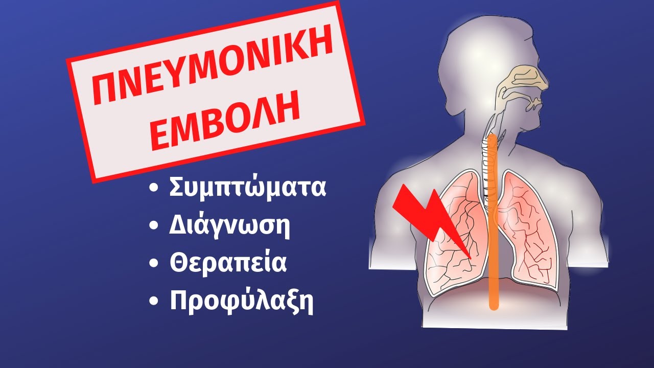 Πνευμονική Εμβολή - YouTube