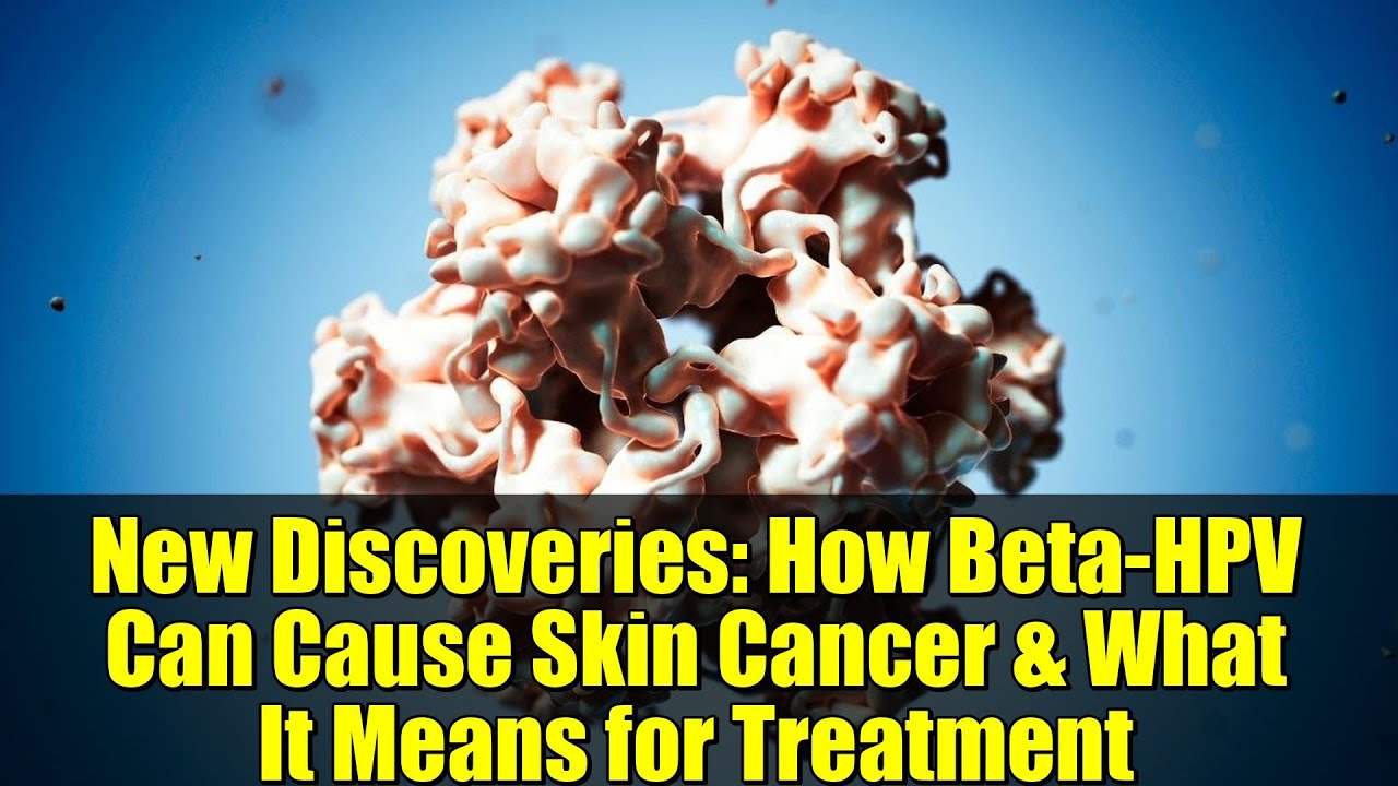 New Discoveries: How Beta-HPV Can Cause Skin Cancer & What It Means for ...