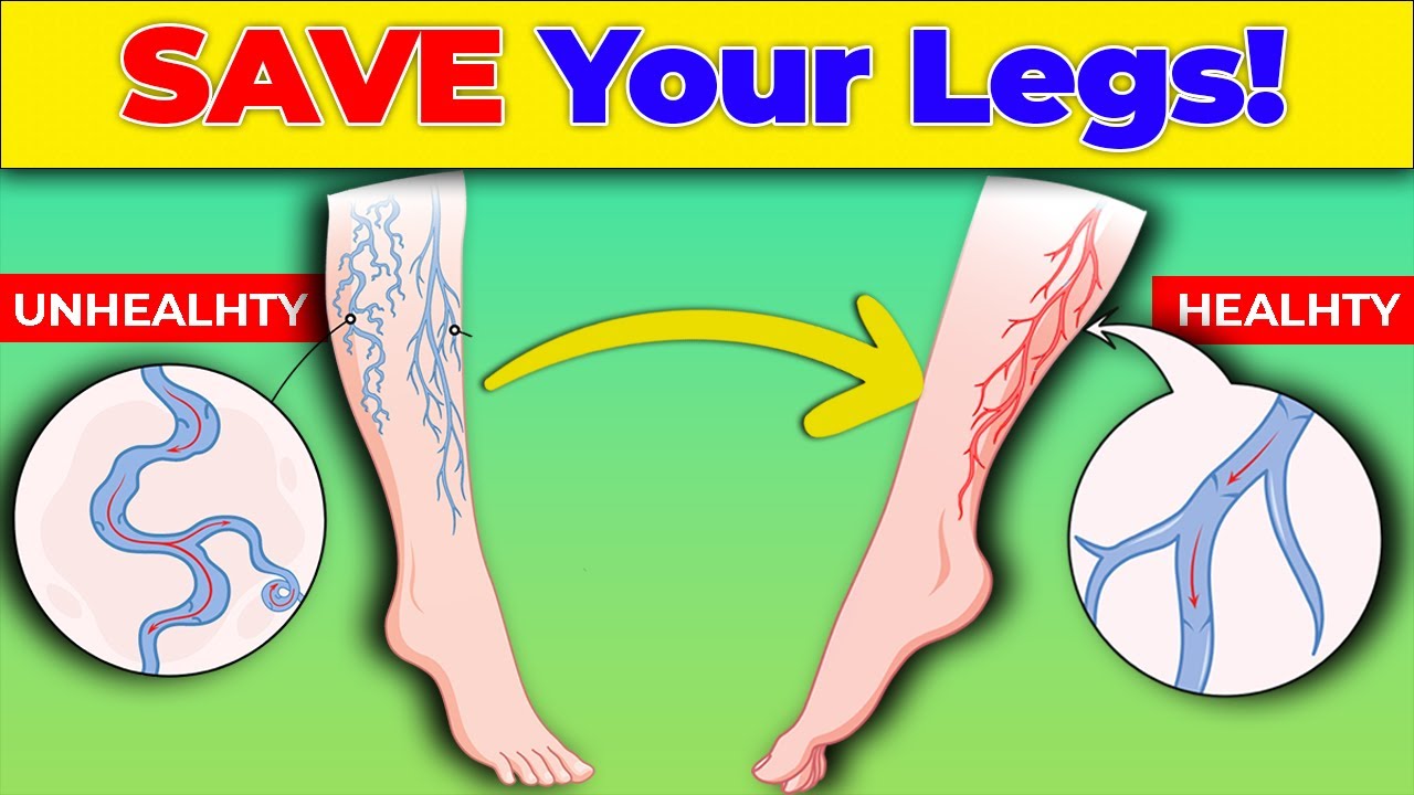 How to Improve Blood Circulation in Your Legs and Feet with 15 Foods ...