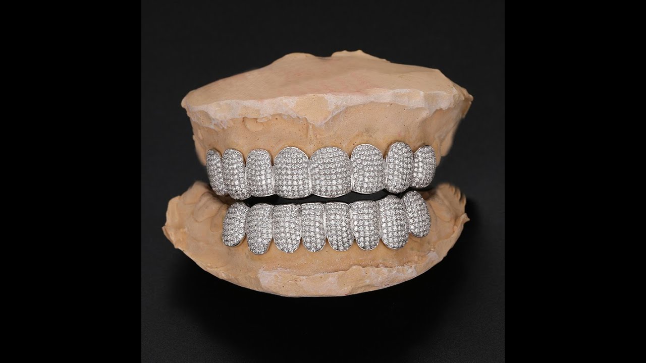 how to make your teeth mold ? @ICEDMINER - YouTube