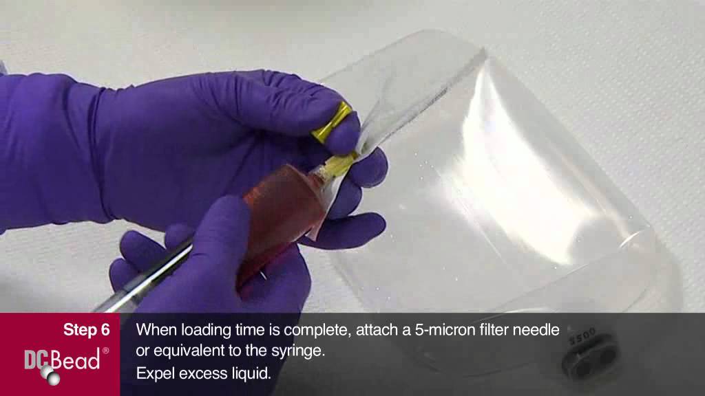 DC Bead Solution - YouTube