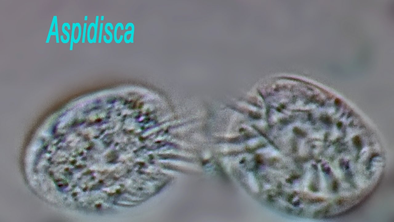 Aspidisca sp - YouTube