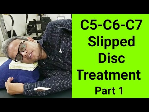 cervical slipped disc physiotherapy C5 C6 C7 slipped disc exercises ...