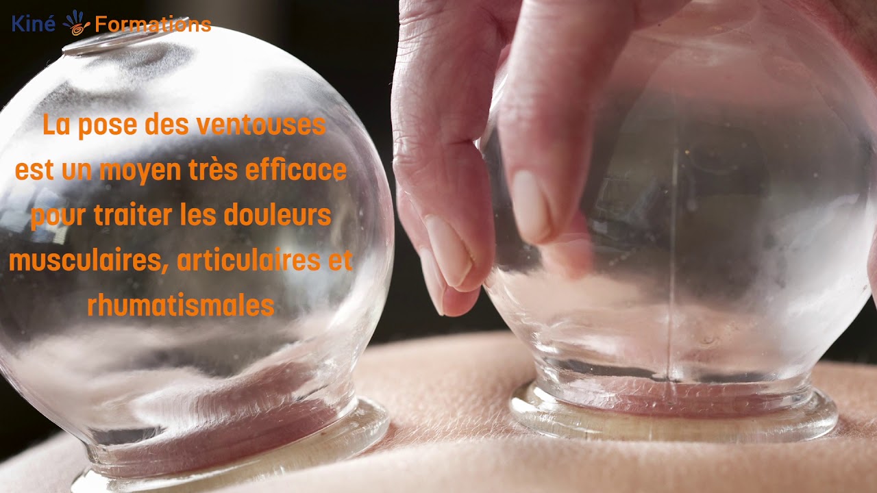 Technique des ventouses - YouTube