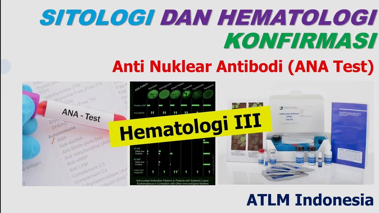 ANA Anti Nuklear Antibodi Test | Autoimun pada kasus SLE Lupus ...