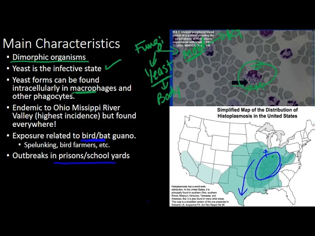 Histoplasmosis Map