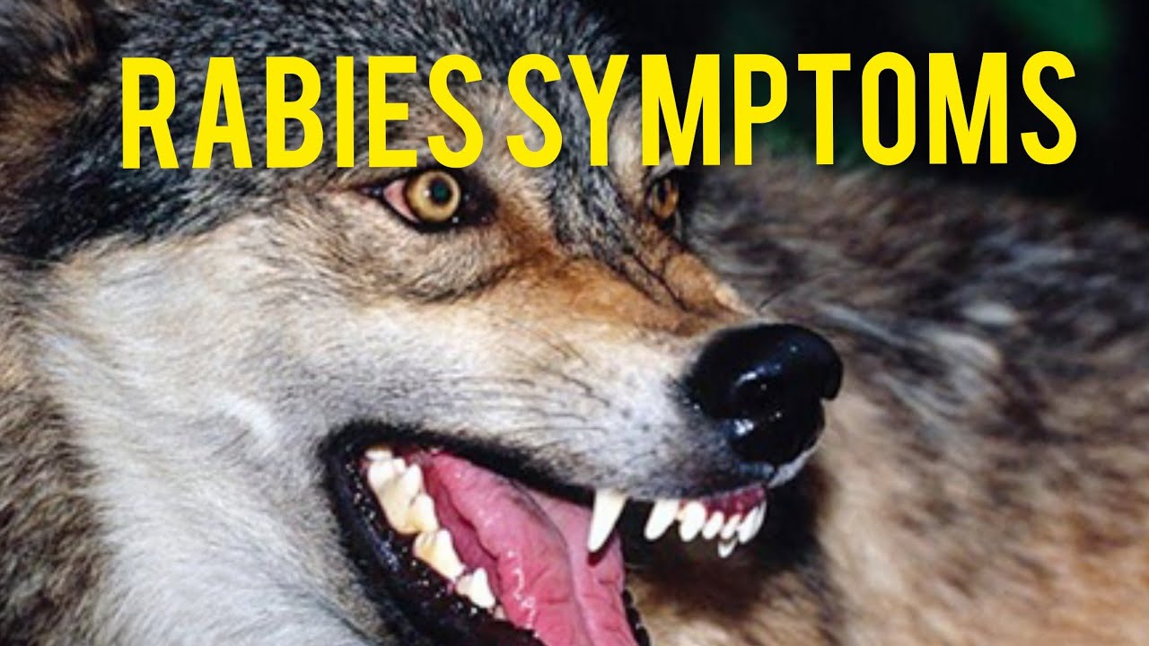 Rabies In A Human Patient Youtube