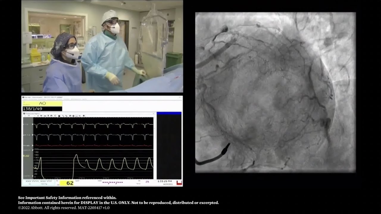 How OCT with Ultreon 1.0 Software Support in Guiding & Optimizing your Procedure: A Calcified ...