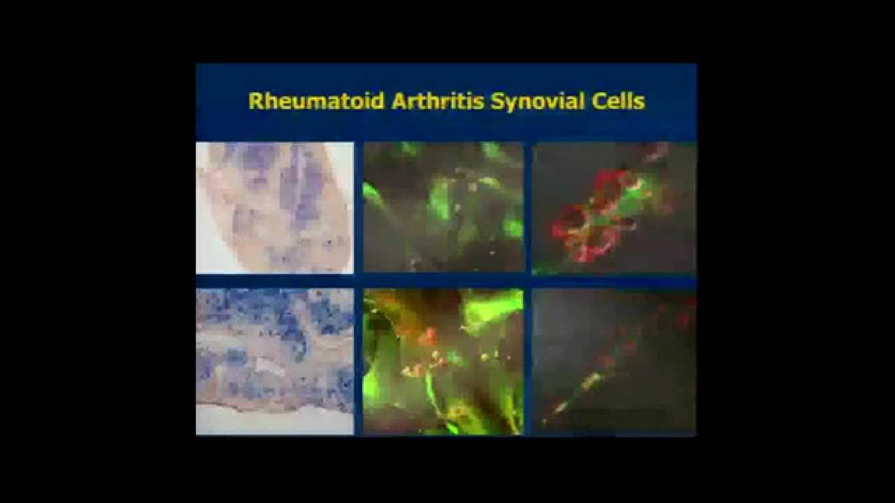 UofL Dept. of Medicine Grand Rounds: Dr. David Fox - YouTube