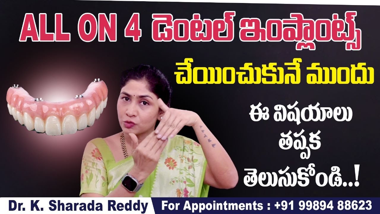 Pros and Cons of All on 4 Dental Implants in Telugu || Dr. K Sharada ...