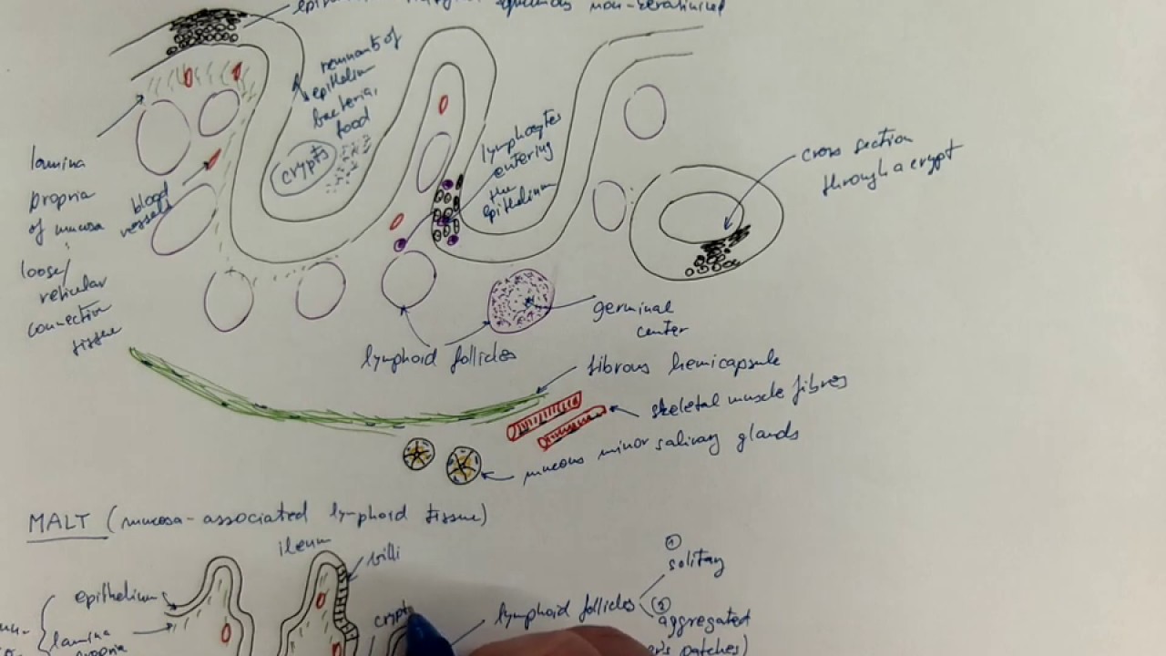 13_03_Palatine tonsil. Mucosa associated lymphoid tissue - YouTube