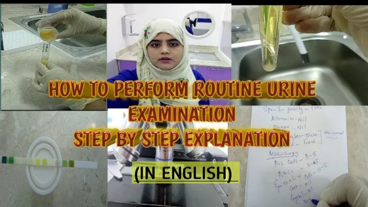 Urine Routine Examination explained step by step in an easy way.how to ...