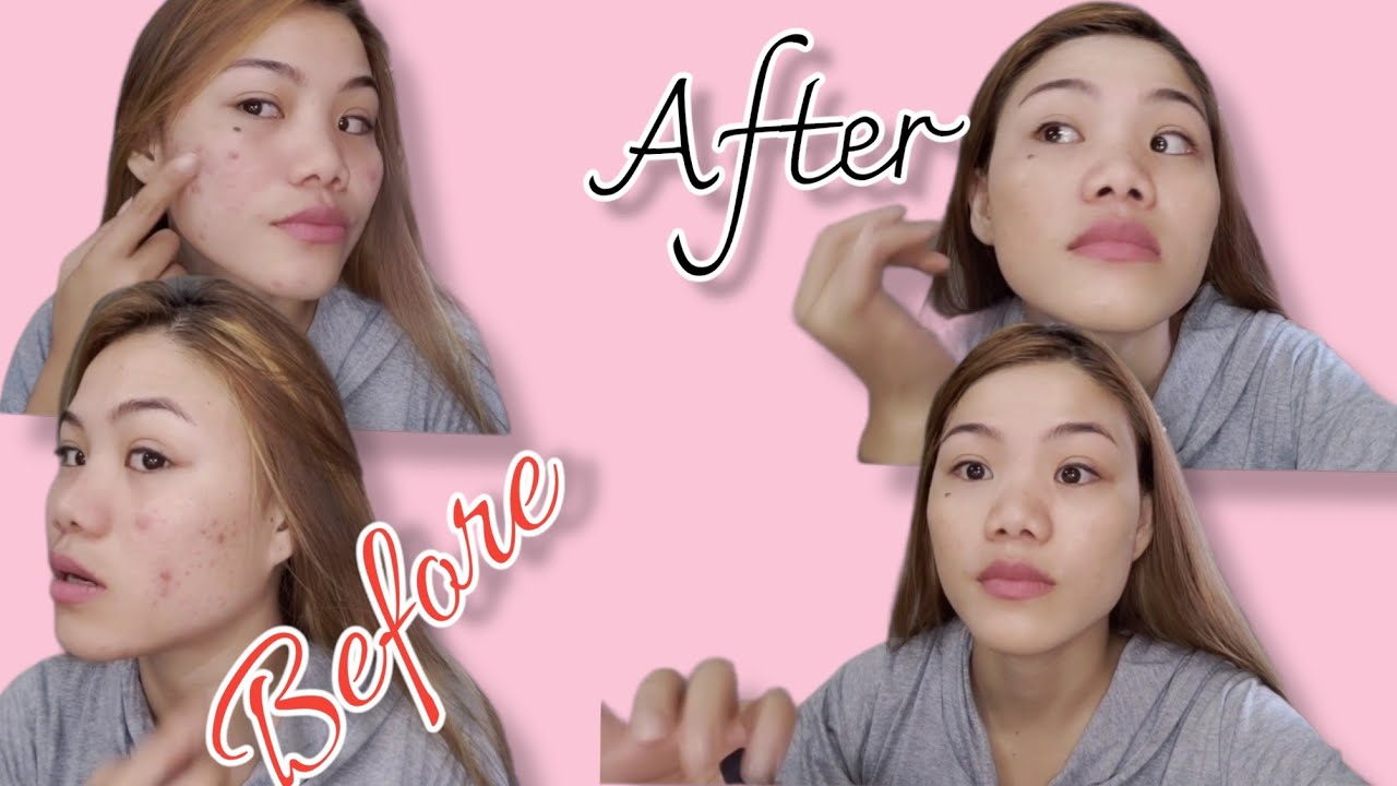 how to hide acne marks?!|pretty elle - YouTube