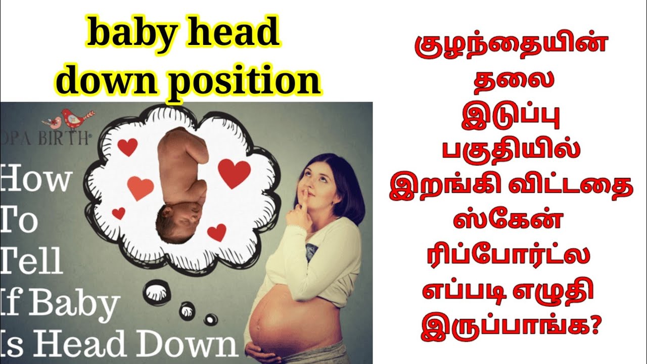 How To Tell If Baby Is Head Down You Can Tell If Baby Head Is Engaged how-to-tell-if-baby-is-head-down-you-can-tell-if-baby-head-is-engaged
